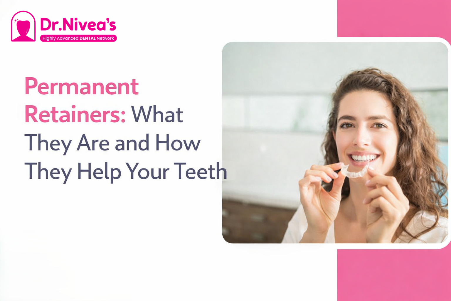 Permanent Retainers: What They Are and How They Help Your Teeth
